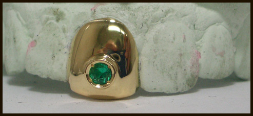 Emerald GRILL!!!! | Grillz Community